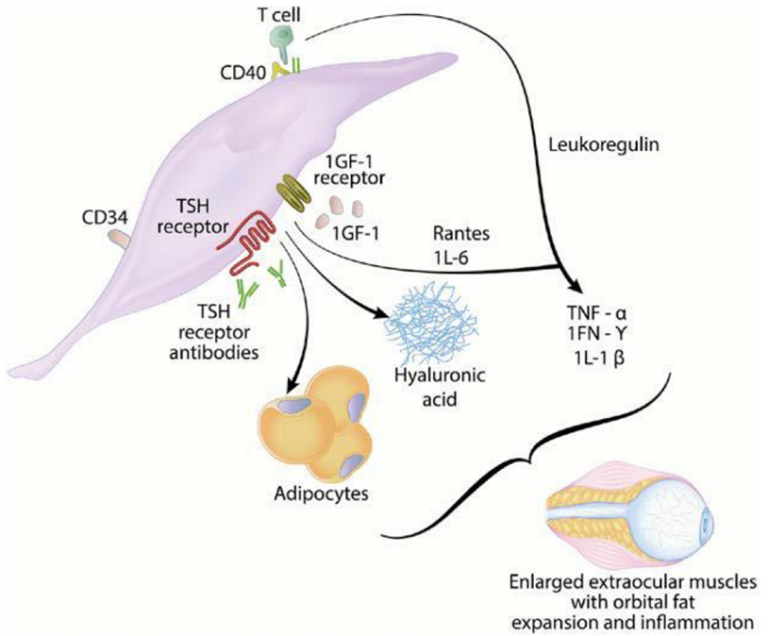 Biến chứng mắt trên bệnh nhân cường giáp basedow – TRUNG TÂM NỘI TIẾT